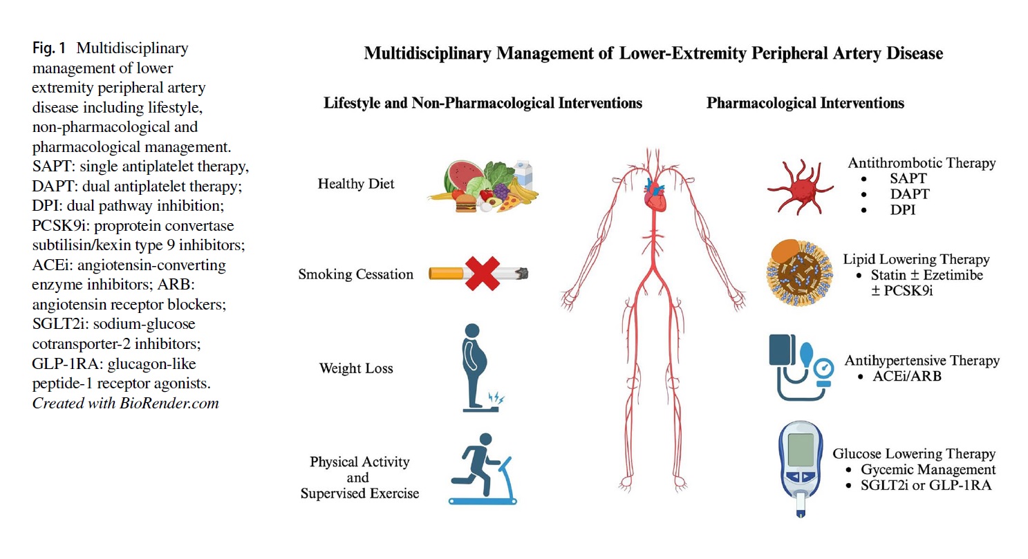 Медикаментозная терапия заболеваний периферических артерий (Current Cardiology Reports, май 2024 ...
