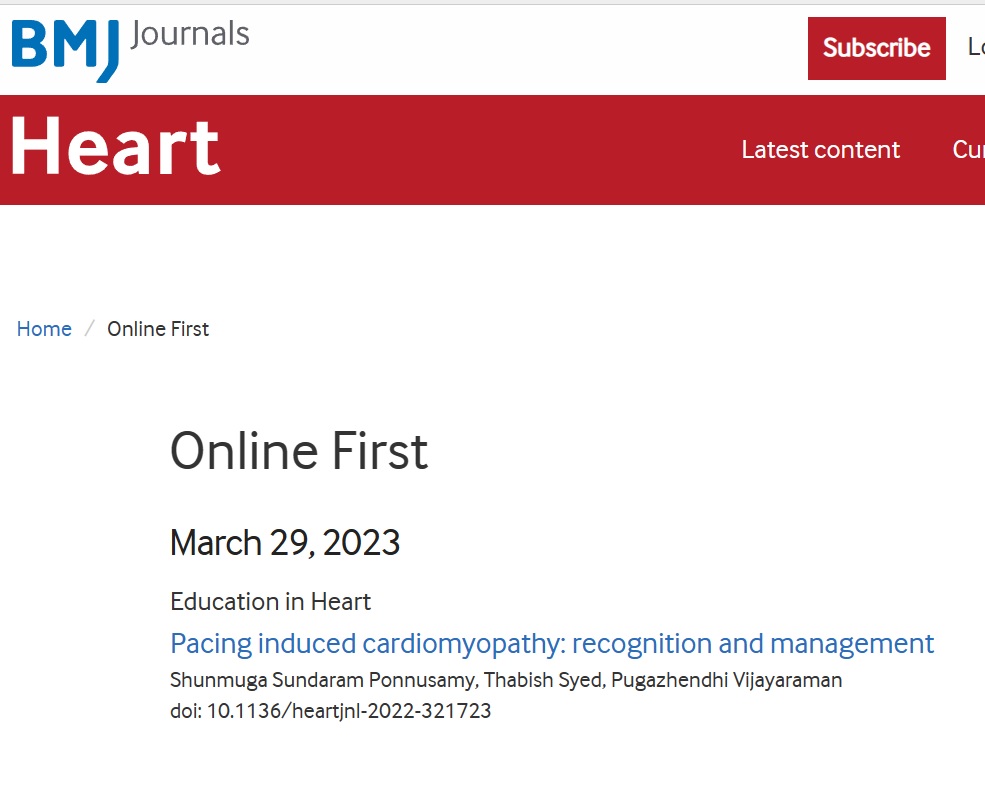Индуцированная пейсингом кардиомиопатия (Heart, март 2023) > MedElement